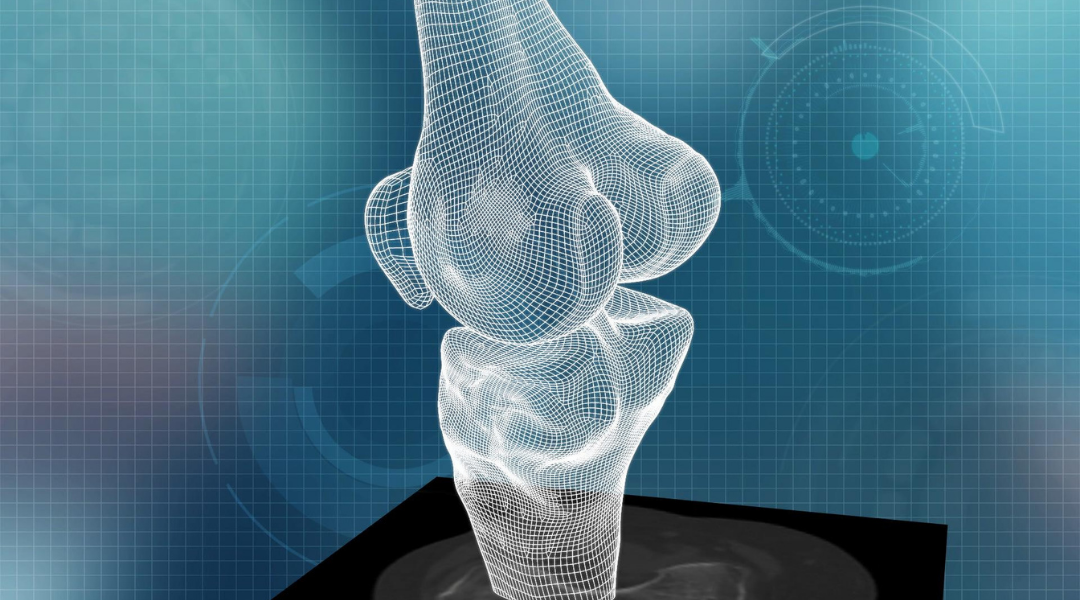 Different Kinds of Knee Replacements | Phoenix Hospital Group